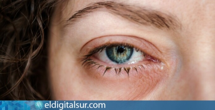 ¿Cómo Quitar los Ojos Hinchados por Llorar Rápido y Discreto?